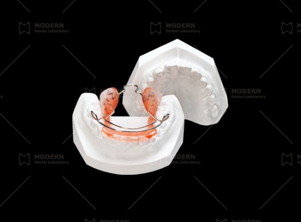 Herbst Appliance – Cast Silver Splint Type – Modern Dental Lab