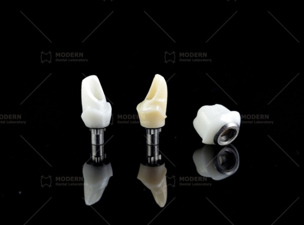 Implant | Modern Dental Lab