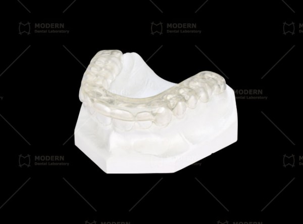 Mouth Guard & Splint | Modern Dental Lab